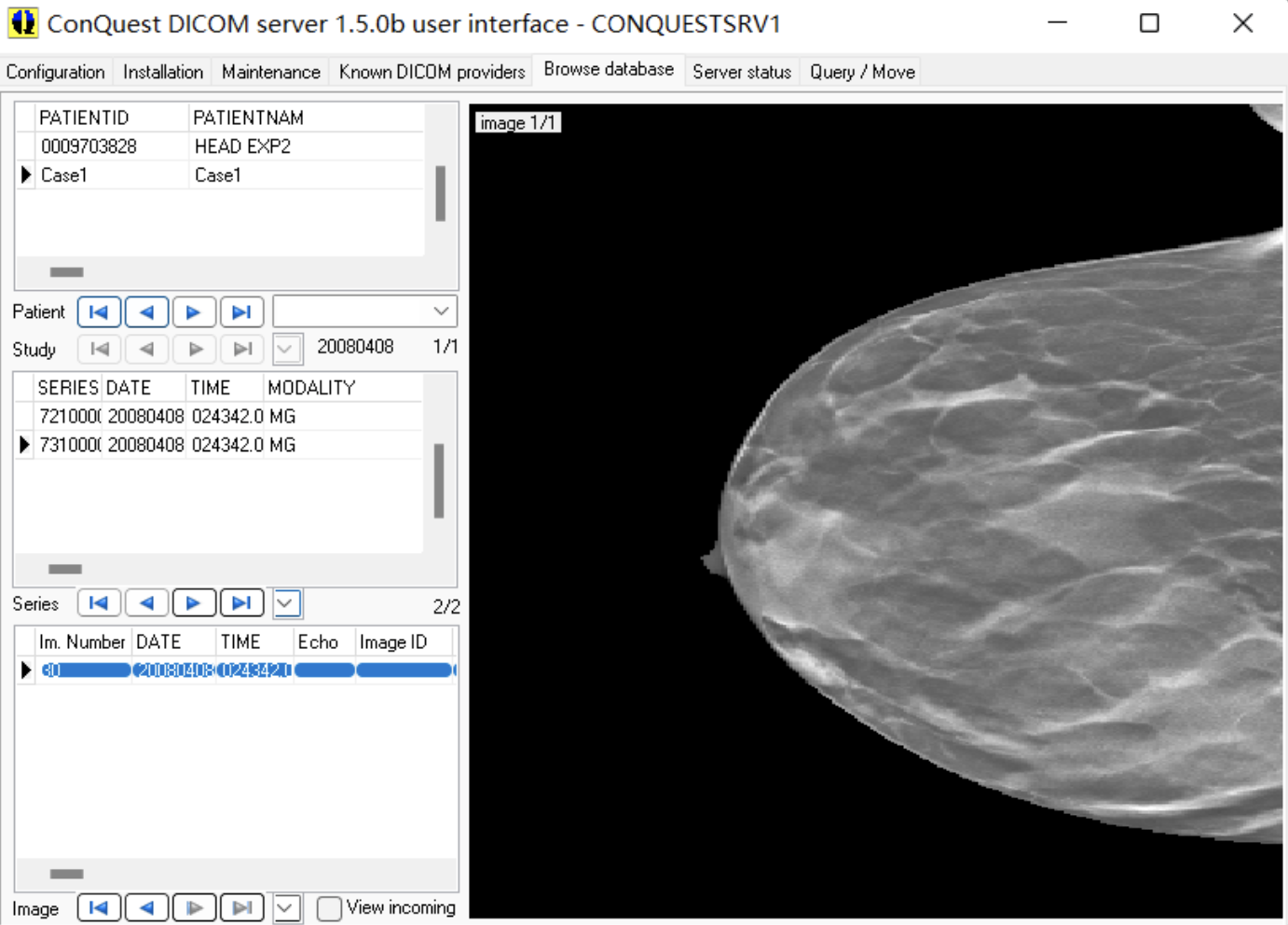 Analysis of DICOM Transfer Protocols - A Random Blog