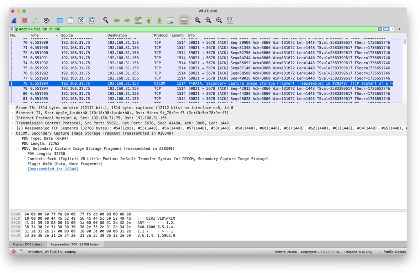Analysis Of Dicom Transfer Protocols A Random Blog