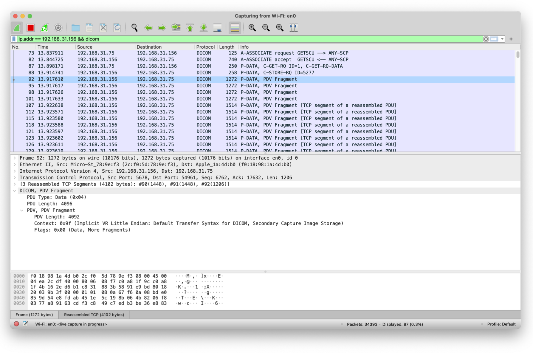 Analysis of DICOM Transfer Protocols - A Random Blog